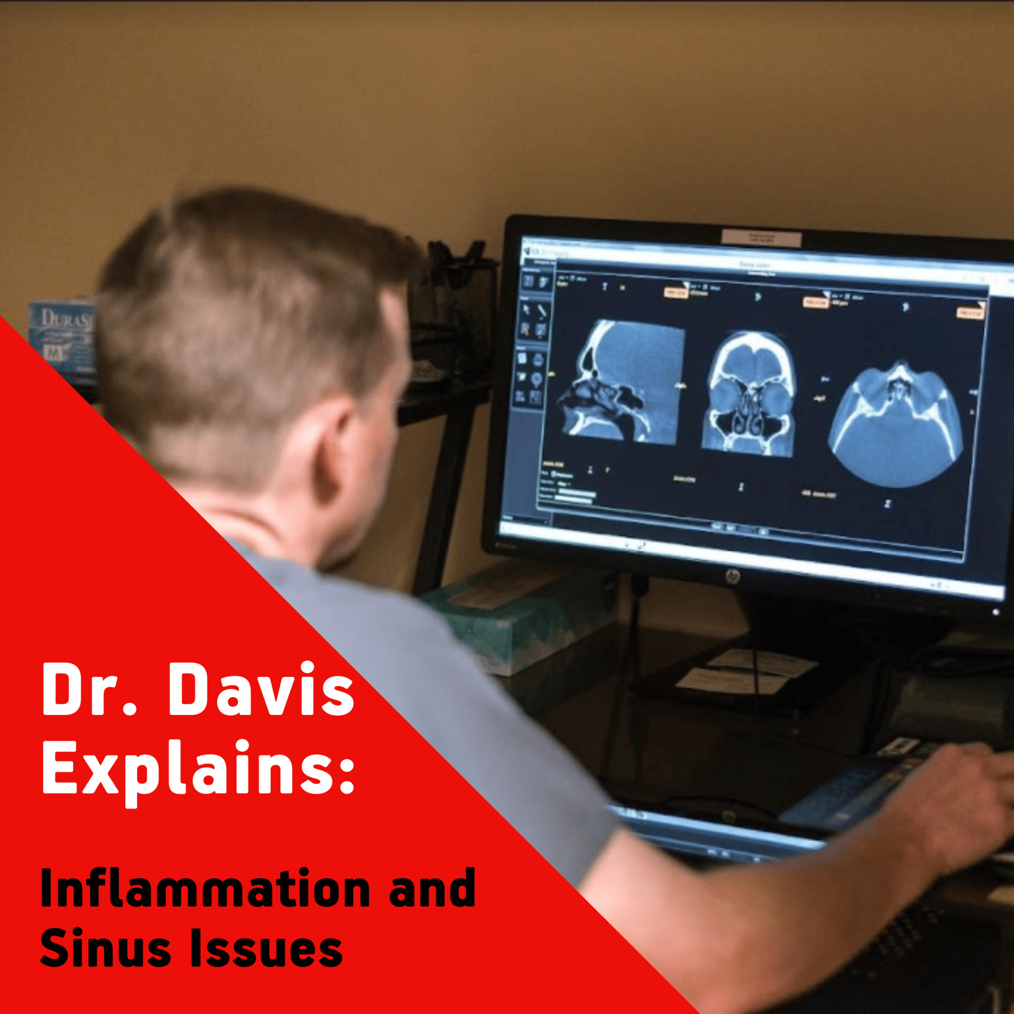 The Driving Force Behind All Sinus Issues: Inflammation - ExcelENT Alabama